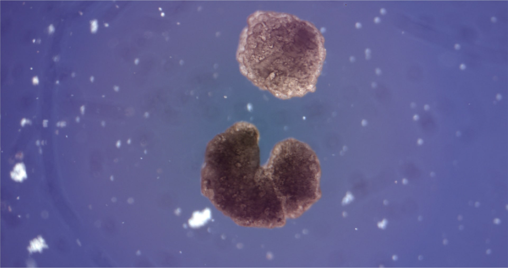 Xenobots: Τα βιο-ρομπότ που μπορούν να αναπαραχθούν